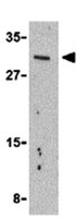 Anti-IL-31 Antibody | ABS455